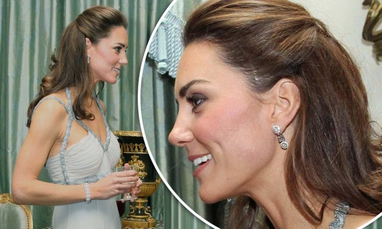 The reason why Princess Kate Middleton has a wound on her head is ...