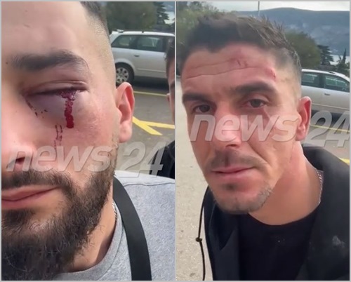 Tre shqiptarë u dhunuan dje në Malin e Zi, policia reagim zyrtar: U ... Tre shqiptarë u dhunuan dje në Malin e Zi, policia reagim zyrtar: U ...