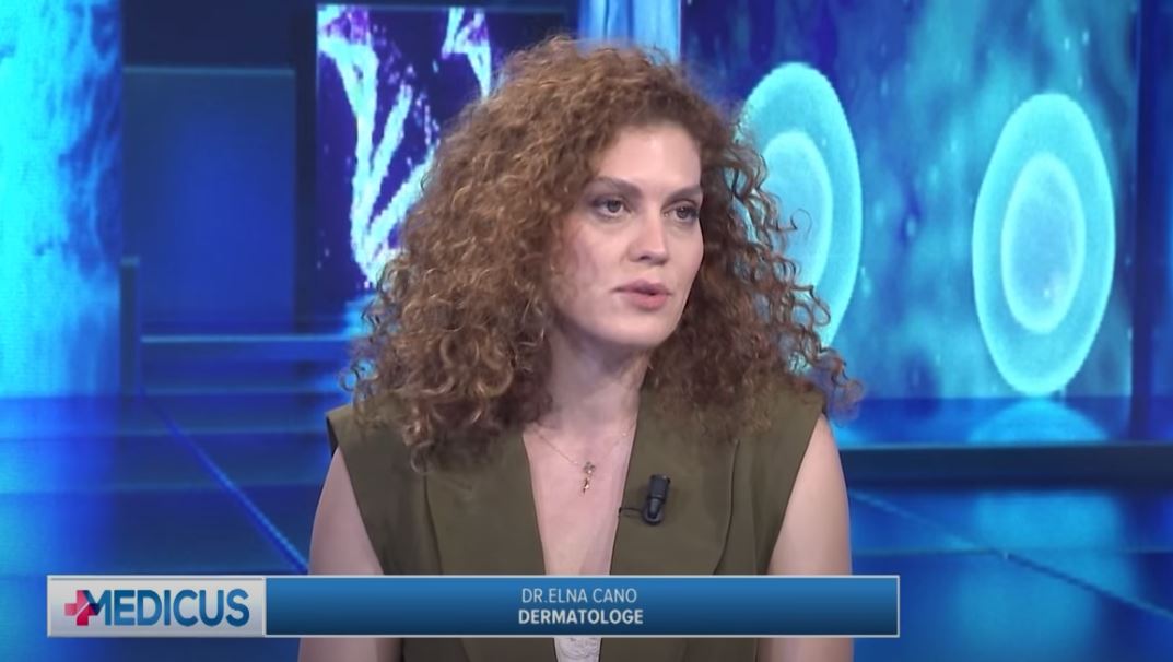 Myku i lëkurës/ Dermatologia Çano në Medicus: Pse përhapet shumë gjatë ...